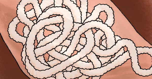 Read Fantastically False Facts About Amazing Animals :: About Tapeworms ...